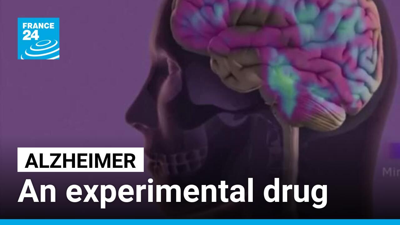 New Alzheimer's treatment: Donanemab drug seen as turning point in fight against disease - France 24